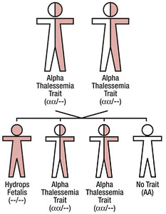 Alpha-thalassémie; hemoglobinopathie h; hemoglobinose h; thalassemie alpha