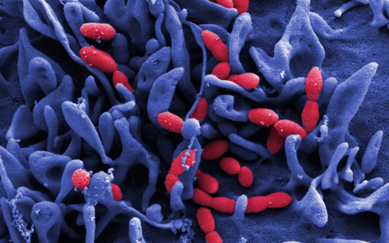 Southeastern Regional Pneumococcal Symposium - St. Jude Children’s ...
