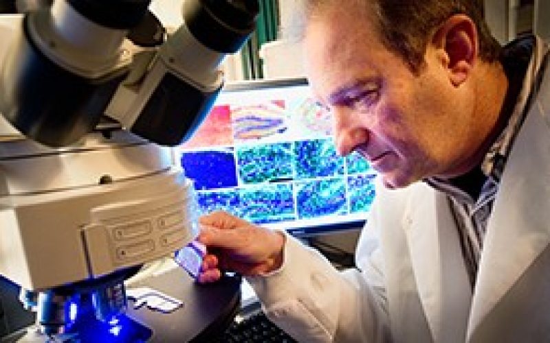 Discovery links rare, childhood neurodegenerative diseases to common ...