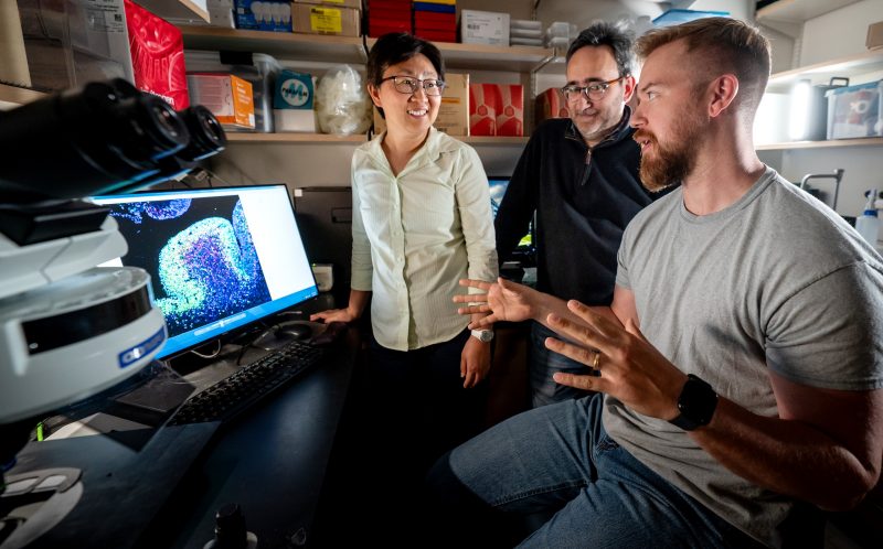 Research reveals unexpected roles of TEAD proteins in neurodevelopment ...